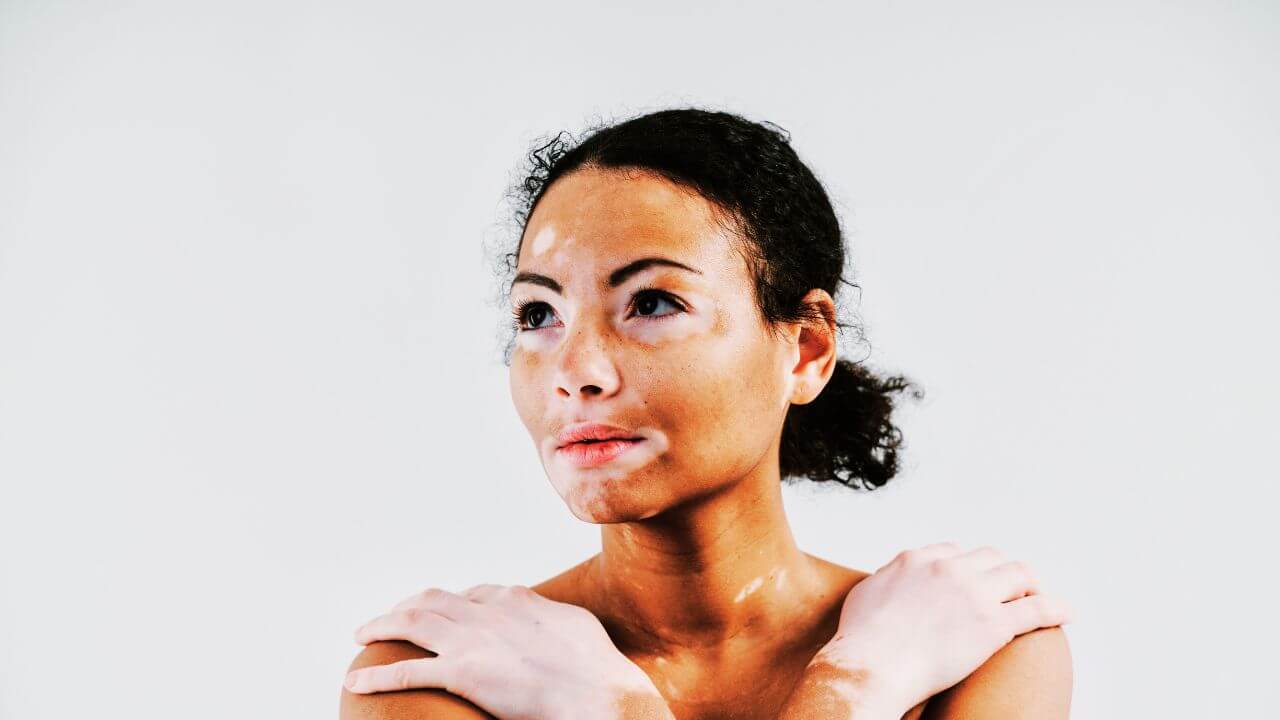 How to Deal With Body Shaming? The Best Action Guide